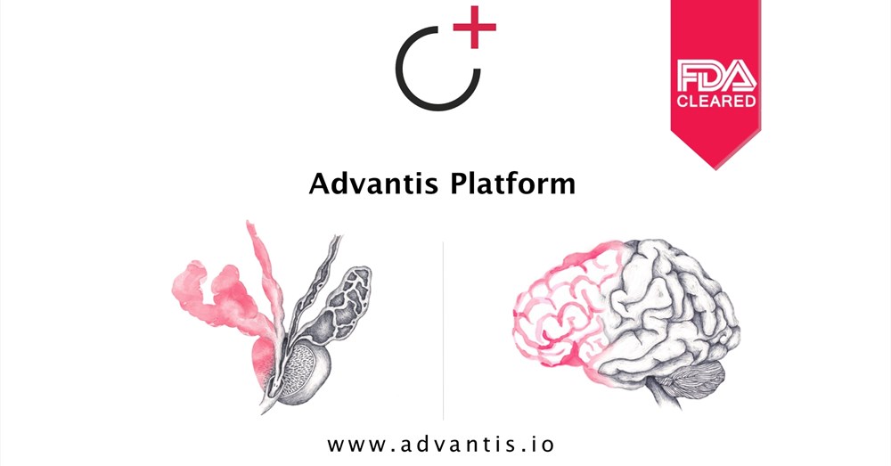 Advantis Medical Imaging: Focus στις ΗΠΑ για την ελληνική startup ...